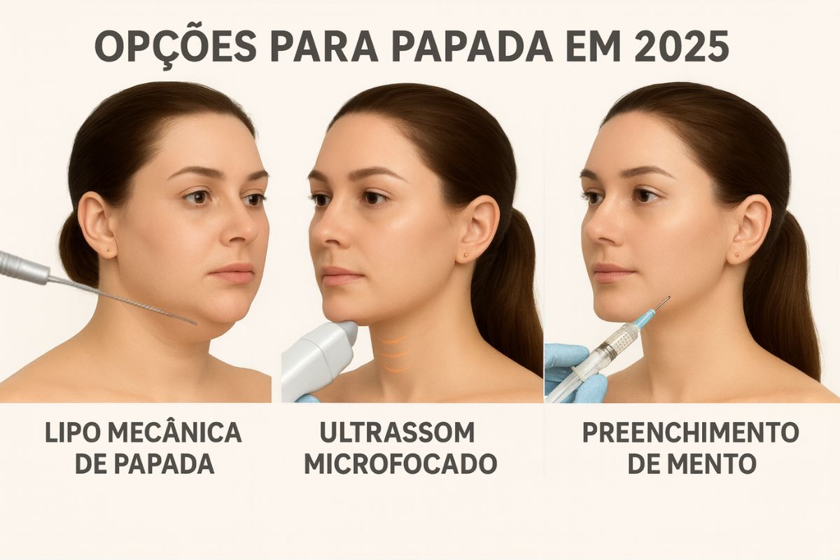 Procedimentos para papada: tratamentos, riscos e resultados